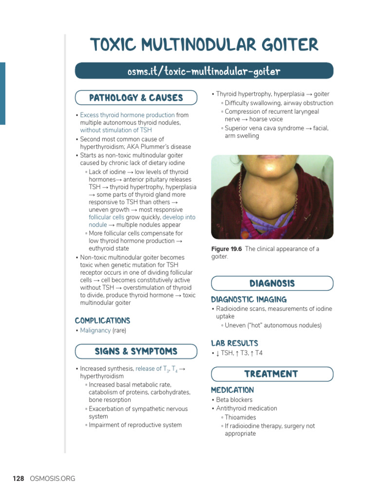 Toxic Multinodular Goiter Overview | PDF