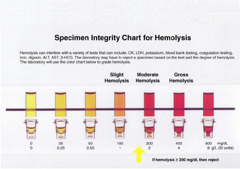 Hemolysis Chart | PDF