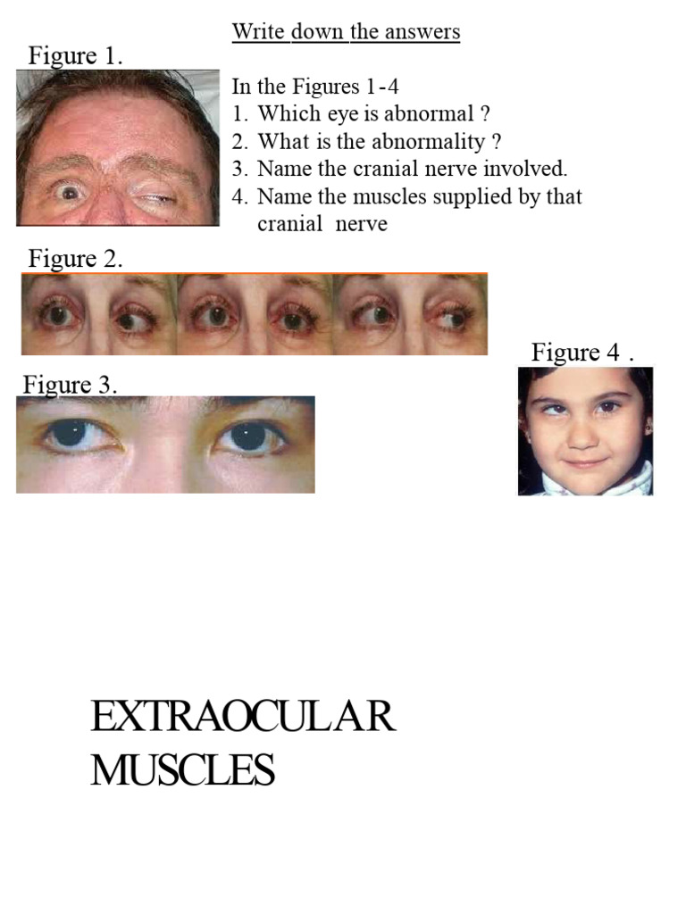 extra-ocular-muscles-ppt | PDF