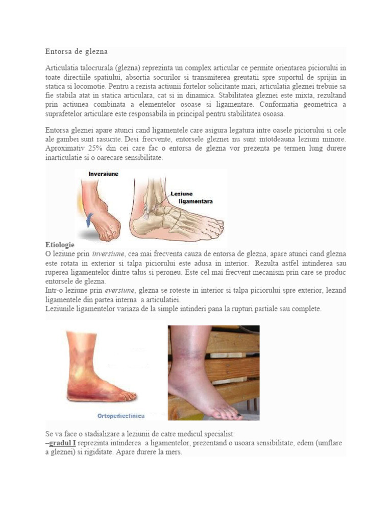 Entorsa Glezna | PDF