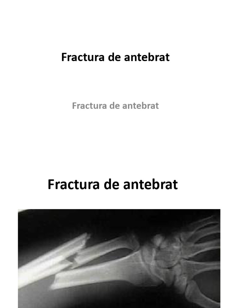 Acturi Antebrat | PDF