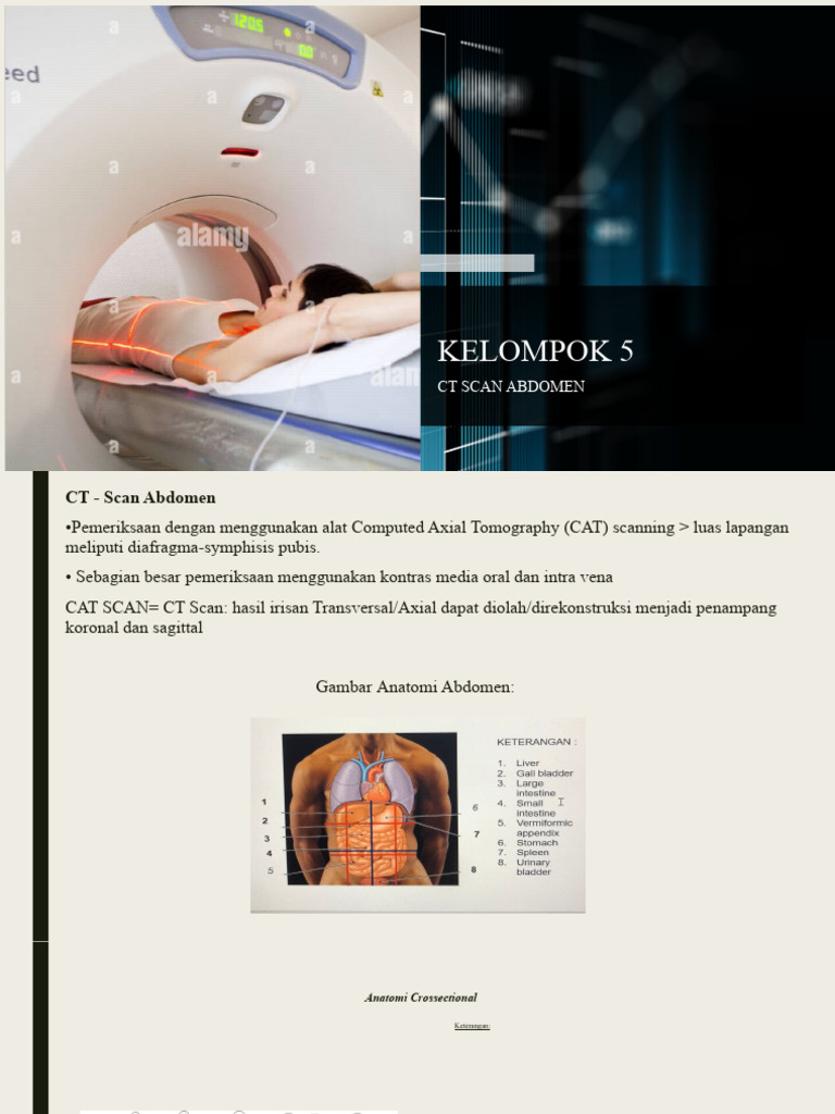 Ppt Ct Scan Abdomen Kelompok 5 Pdf