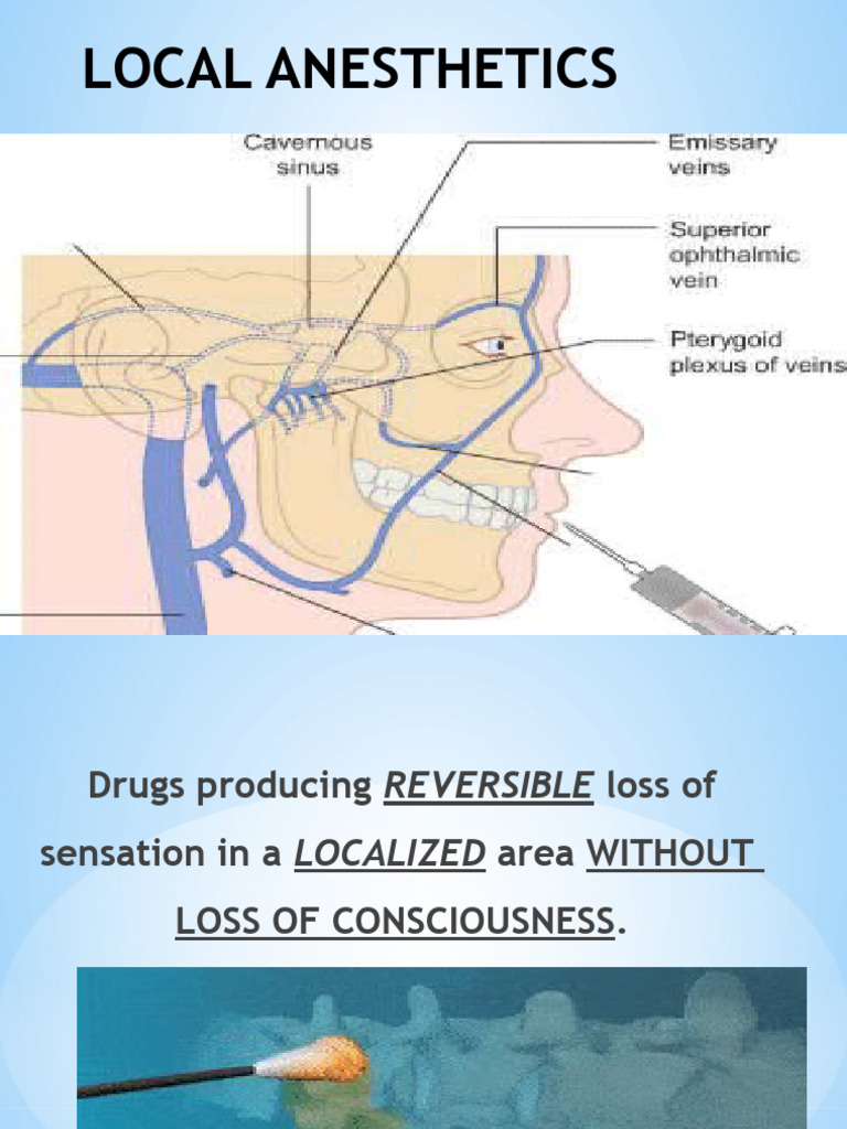 LOCAL ANESTHETICS DPT 10012022 031008pm 09122023 042201pm | PDF ...