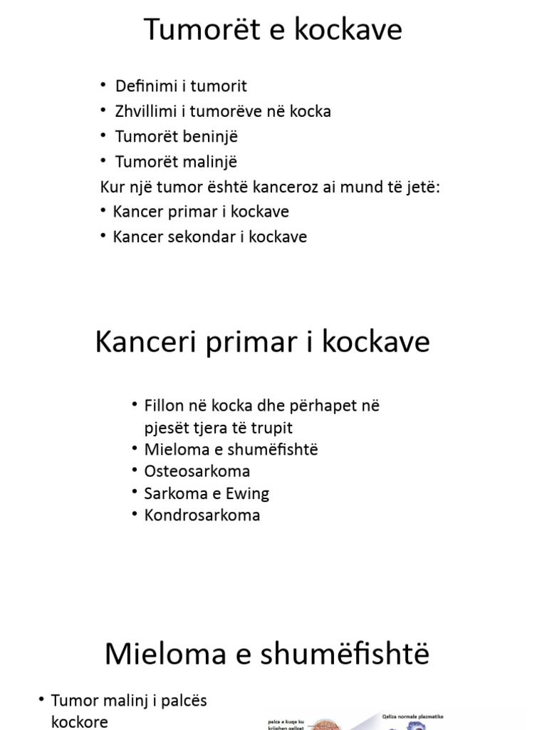 Tumorët e Kockave | PDF