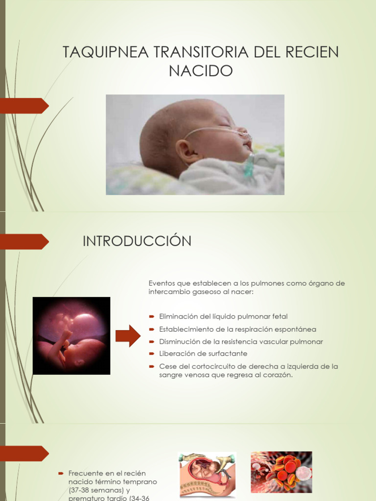 SDR Taquipnea Transitoria Del Recien Nacido | PDF