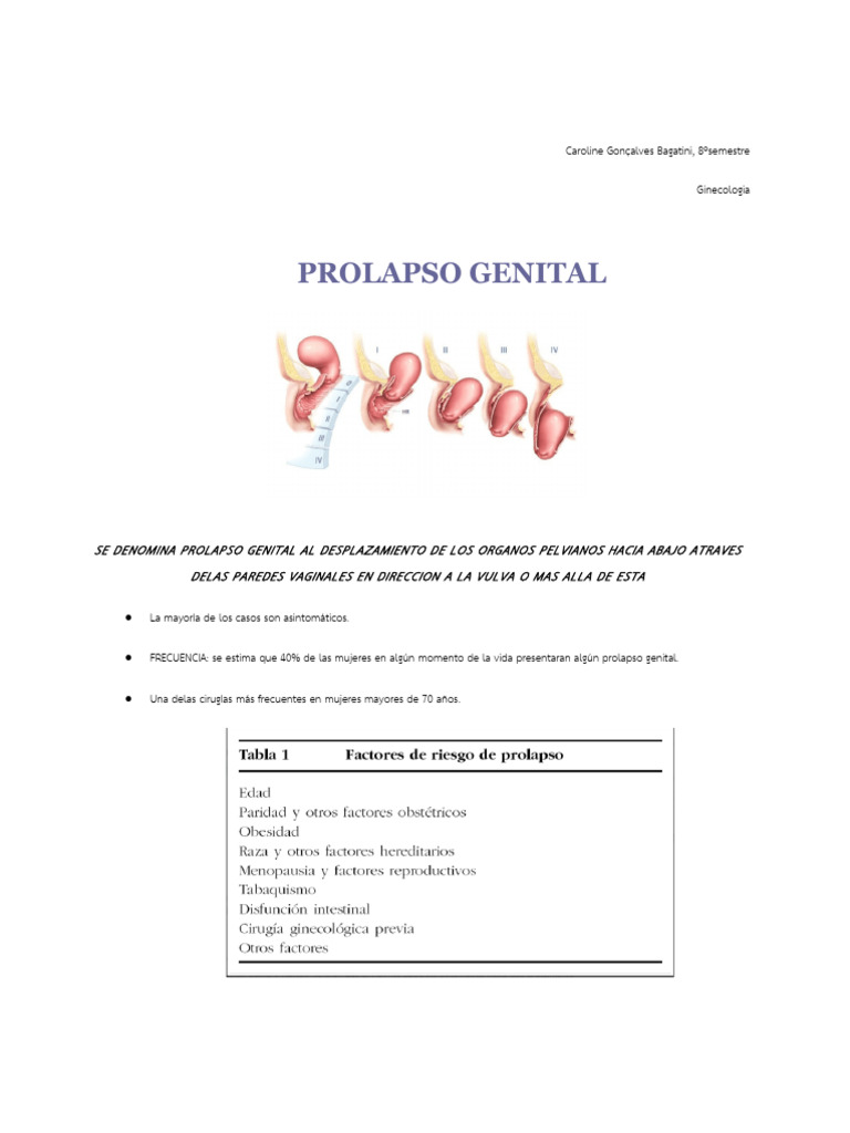 Prolapso Genital - Ep2 - 8 Semestre - Bagatini | PDF | Especialidades Medicas | Medicina CLINICA