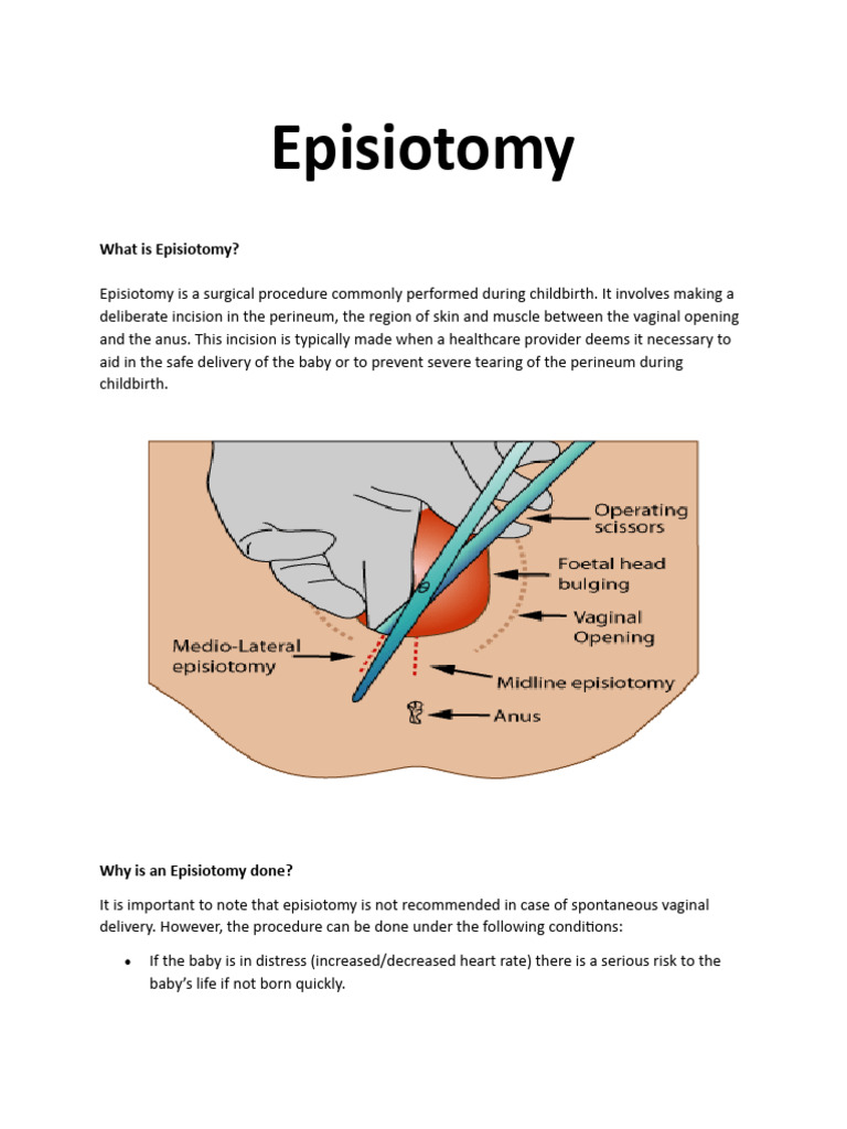 Episiotomy | PDF | Childbirth | Vagina