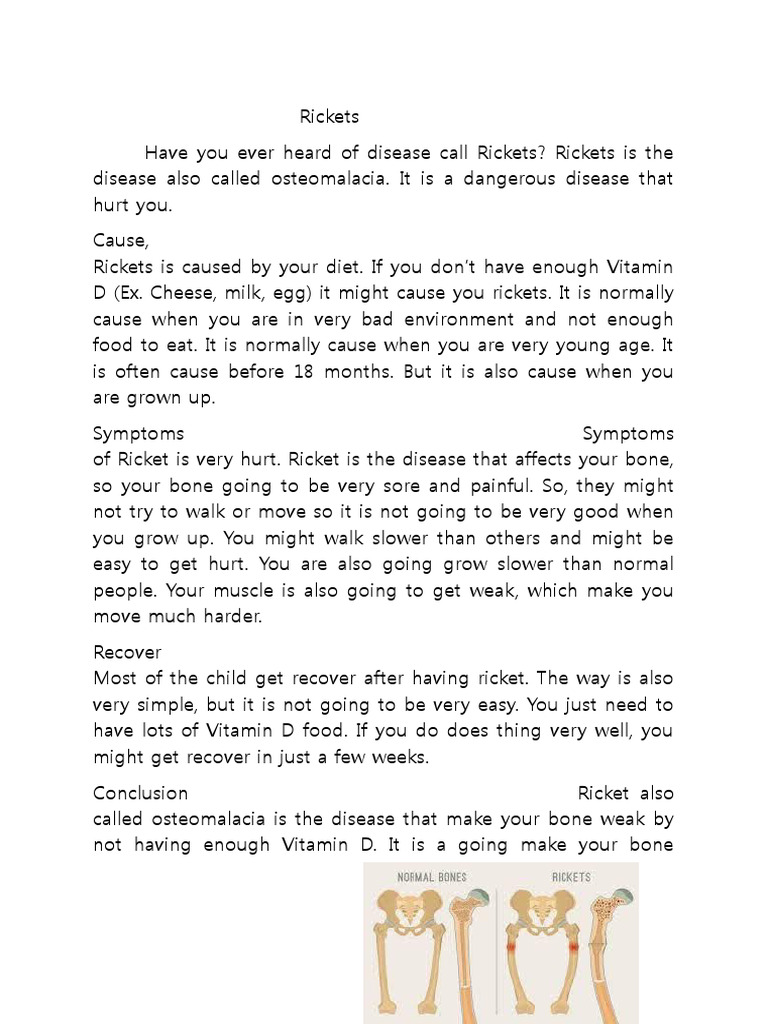 Rickets | PDF