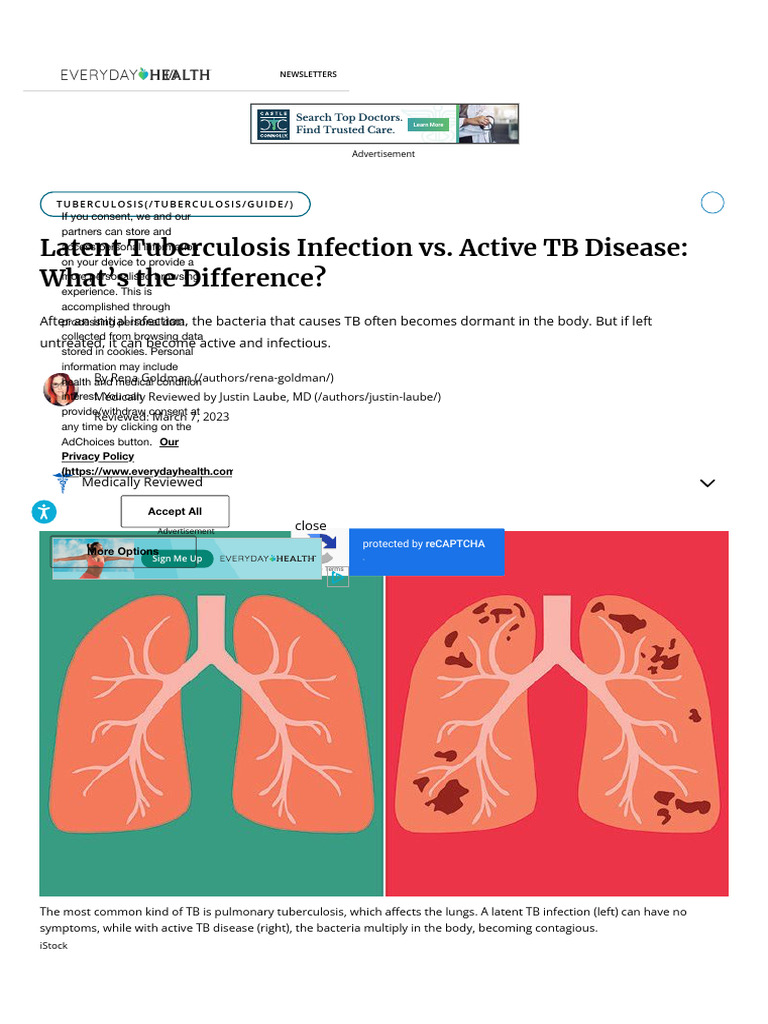 Latent Tuberculosis Infection vs. Active TB Disea | PDF | Tuberculosis | Infection
