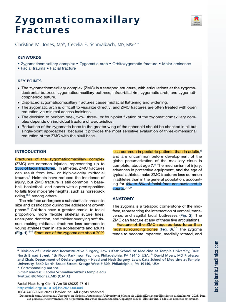 Zygomaticomaxillary Fractures