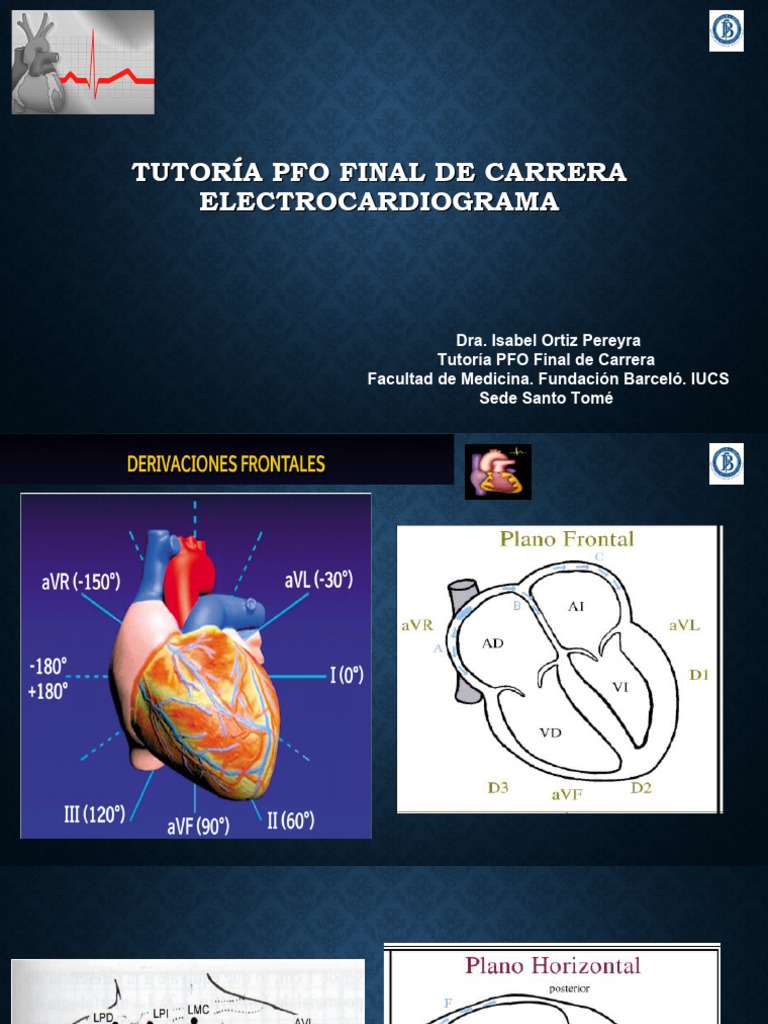 Nuevo Tutoría Ecg Pfo Final de Carrera 2023 | PDF | Electrocardiografia ...