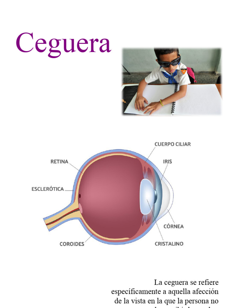 Ceguera: causas, síntomas y tratamiento | PDF