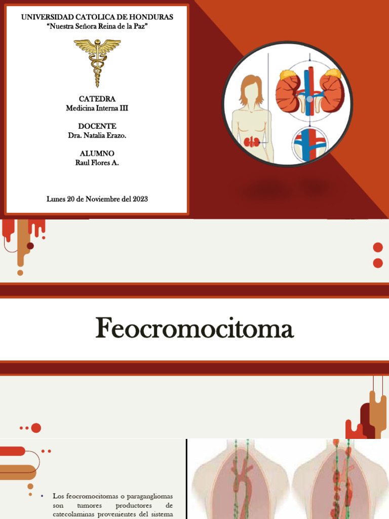 Feocromocitoma: Diagnóstico y Tratamiento | PDF | Medicina CLINICA ...