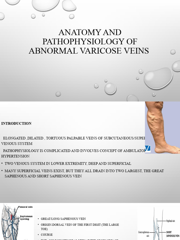 Varicose Veins | PDF | Vein | Angiology