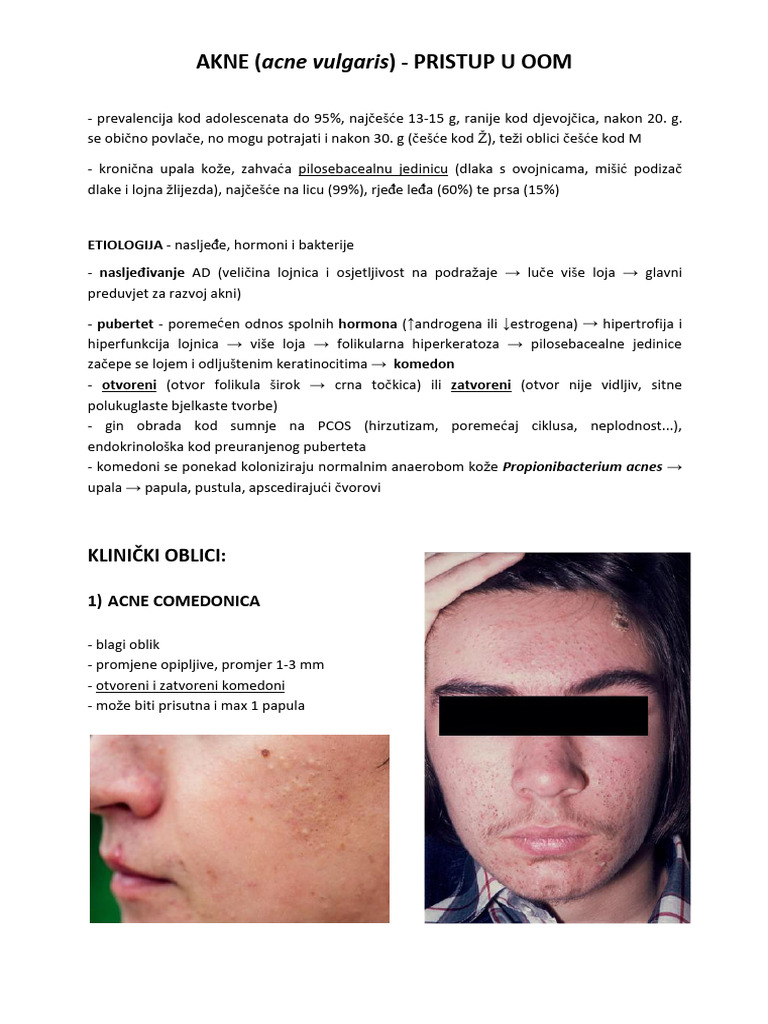 AKNE | PDF