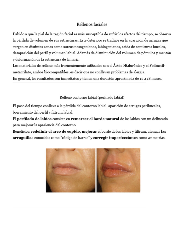 Rellenos Faciales | PDF | Cara | Anatomía humana