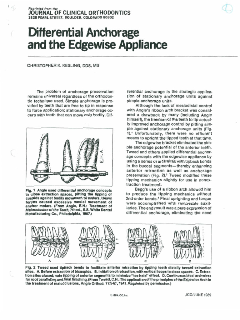 Differential Anchorage and The Edgewise Appliance | PDF