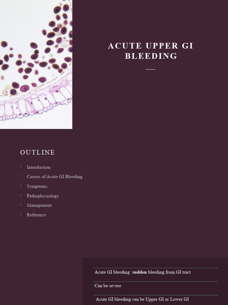 Acute Upper GI Bleeding | PDF | Digestive System | Causes Of Death
