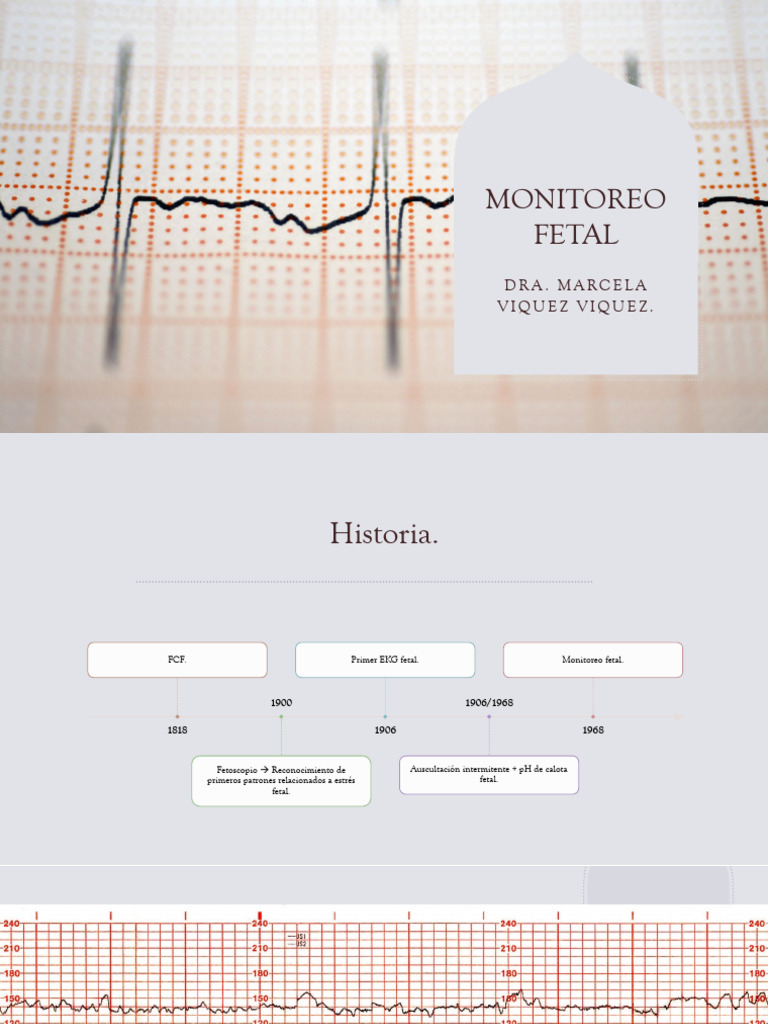 Monitoreo Fetal | PDF