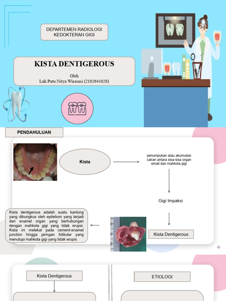 REVISI - PPT Case Report Periodontitis Kronis - Luh Putu Nitya Wirasasi - 2102641028 | PDF