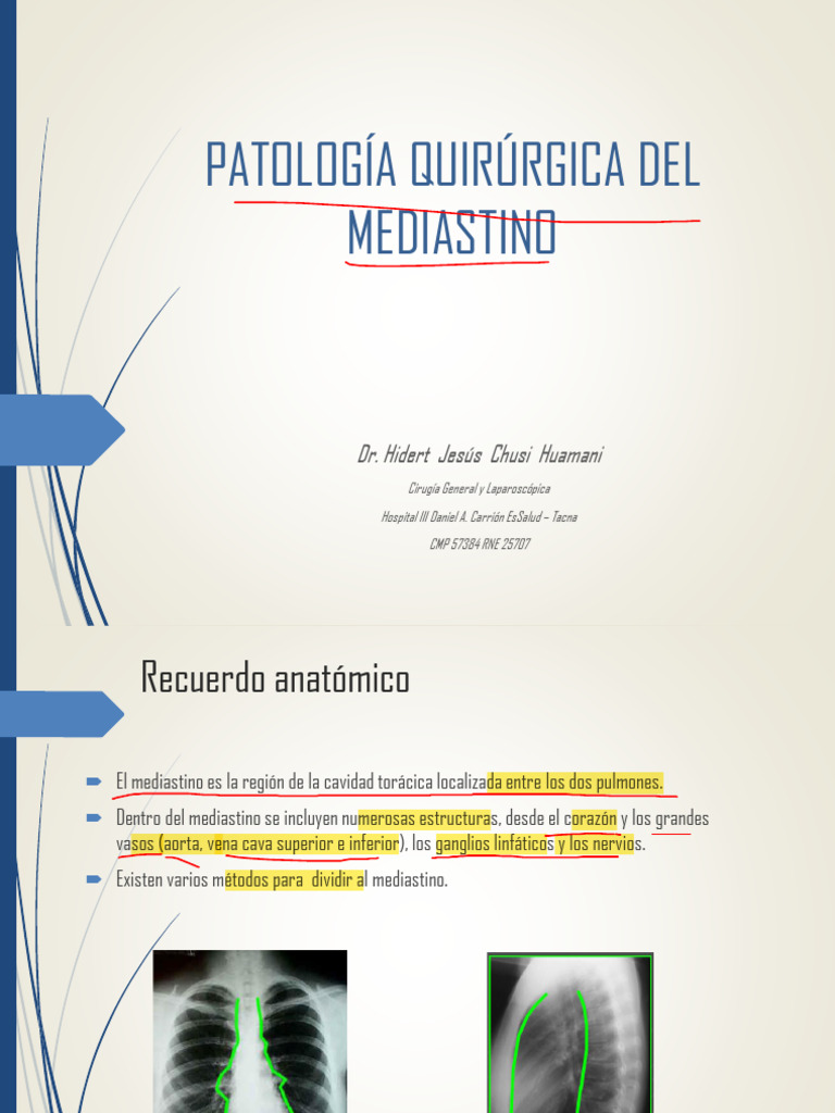 Patología Quirurgica Del Mediastino | PDF | Especialidades Medicas | Medicina CLINICA