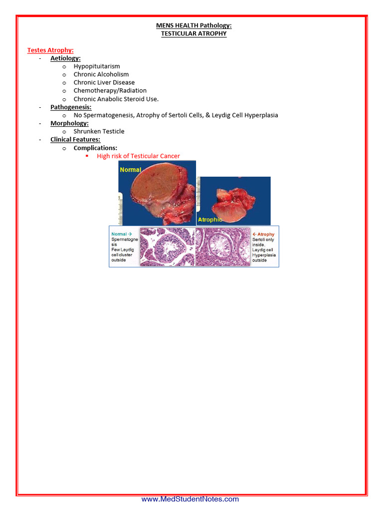 MENS - Testicular Atrophy (1p) | PDF