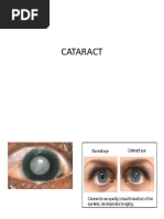 Locs Iii | PDF | Cataract | Color