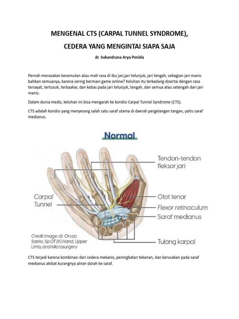 Mengenal CTS | PDF