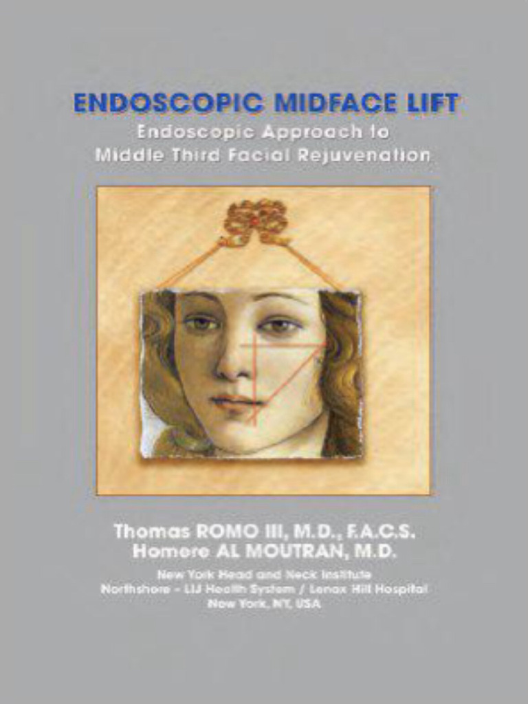 Endoscopic Mid Face Lift | PDF | Human Anatomy | Human Head And Neck