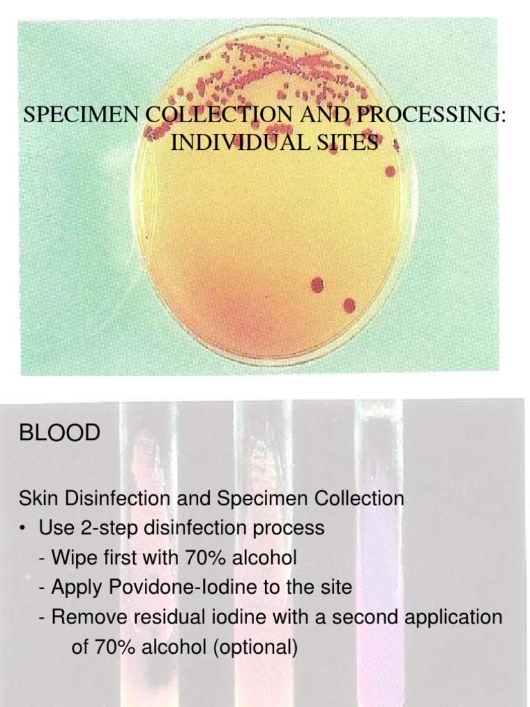 Specimen Collection, Transport and Processing | PDF | Meningitis ...