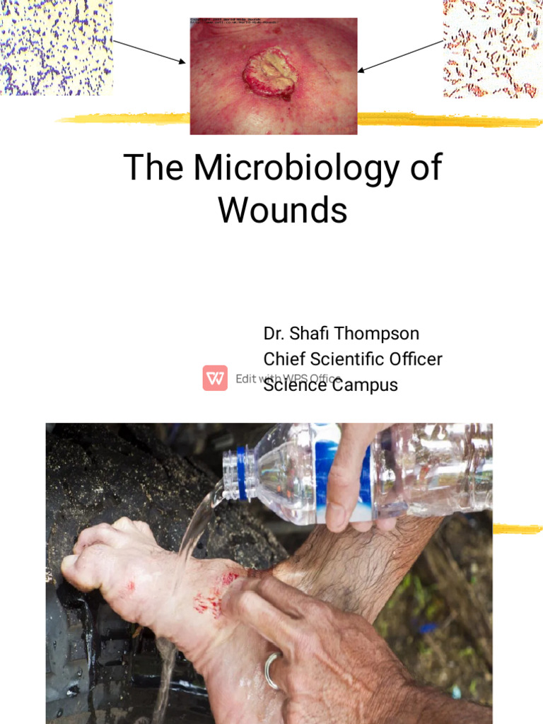 Wound, Physiotherapy Care | PDF | Streptococcus | Infection