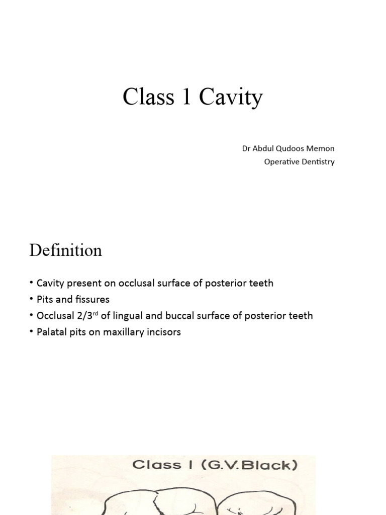 Class 1 Cavity-1 | PDF