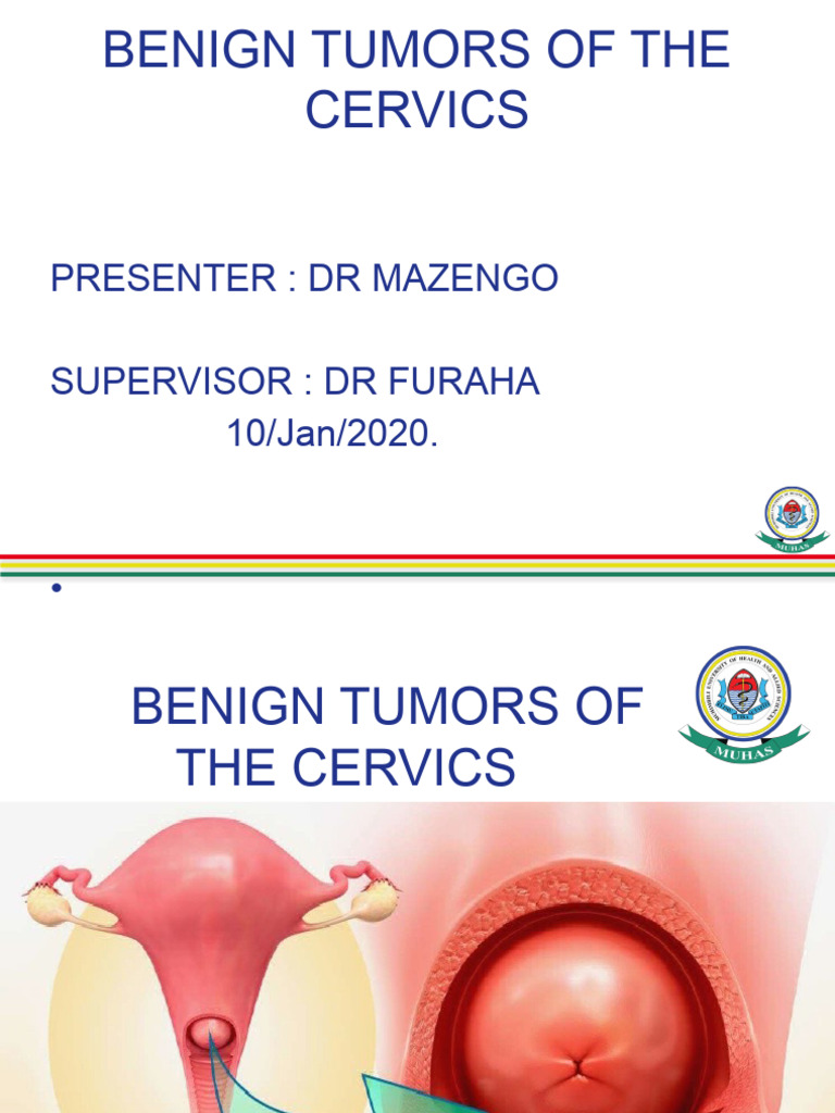 Understanding Benign Cervical Tumors | PDF | Human Reproduction | Medicine