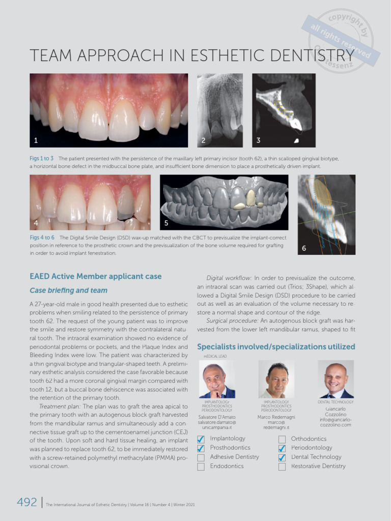 Team Approach in Esthetic Dentistry.b | PDF | Dental Implant | Periodontology