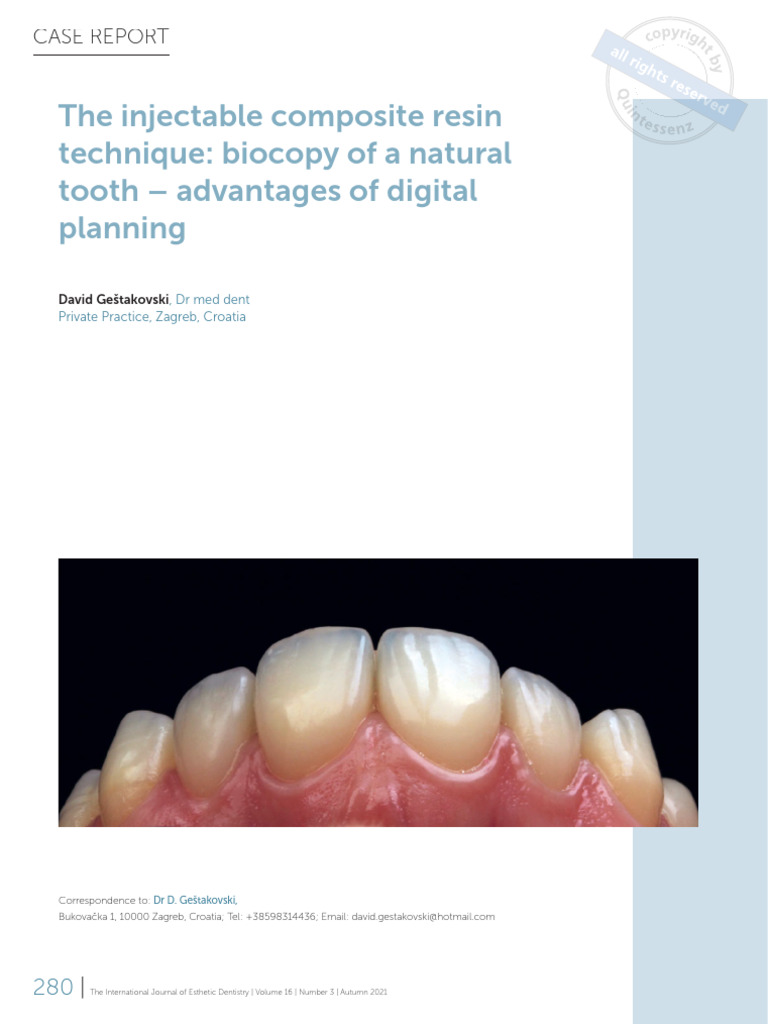 The Injectable Composite Resin Technique Biocopy of A Natural Tooth ...