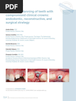 Tunneled Coronally Advanced Flap For The Treatment of Isolated Gingival ...