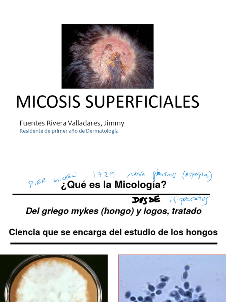 Micosis Superficiales - Jimmy | PDF | Hongo | Organismos