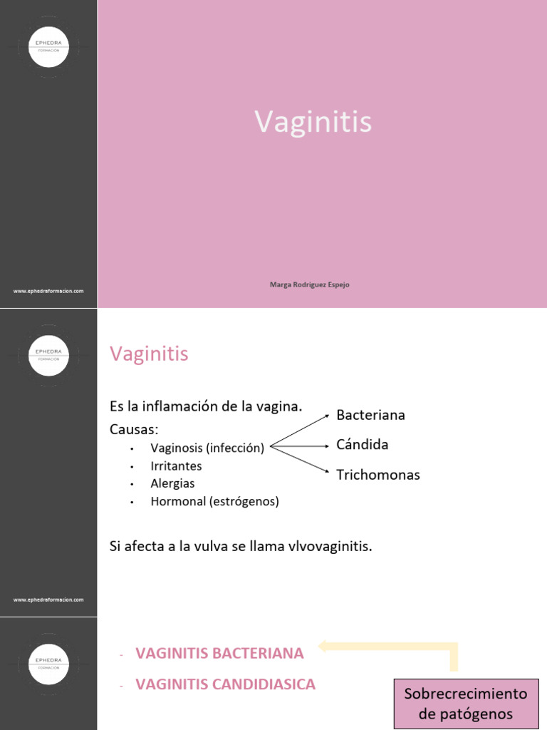 Vaginitis | Descargar gratis PDF | Medicina CLINICA | Reproducción humana
