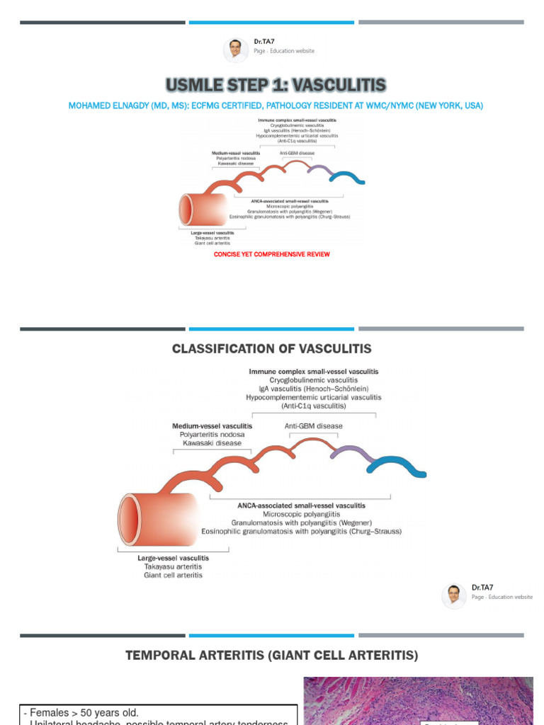 Vasculitis PPT Notes | Download Free PDF | Human Diseases And Disorders ...