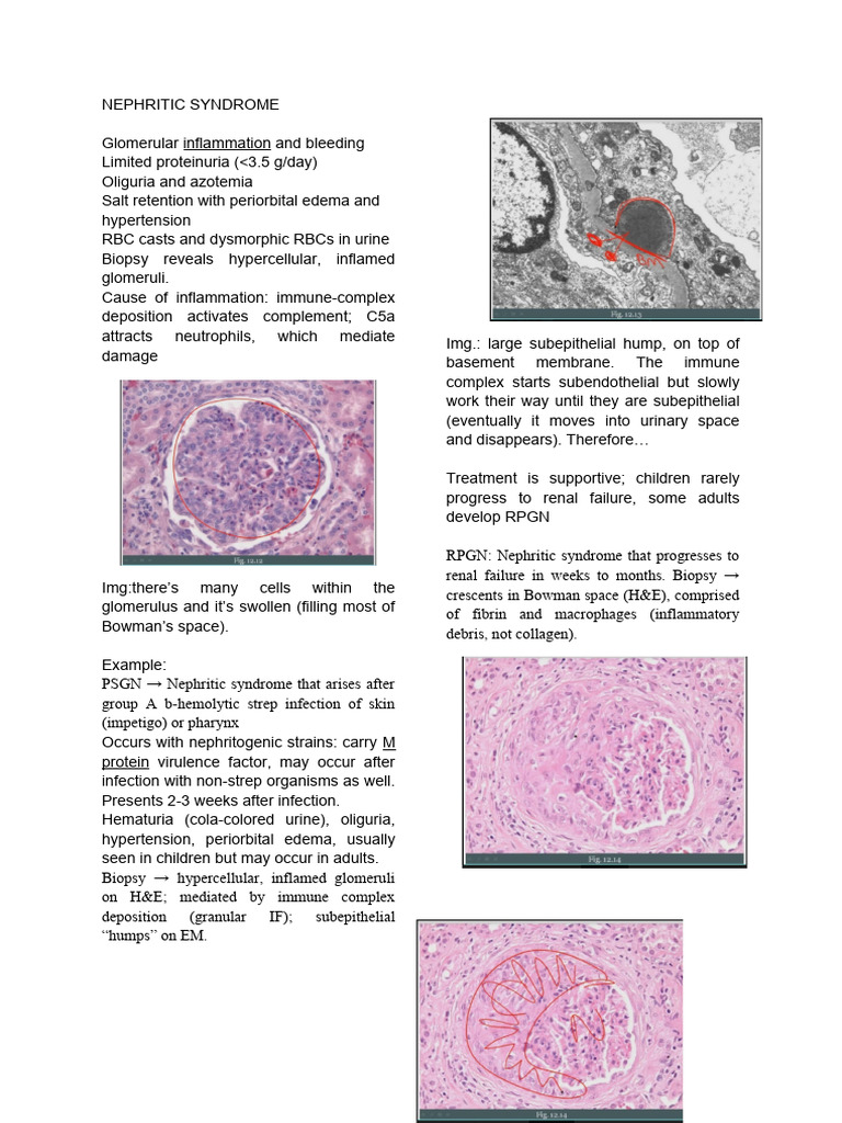 Nephritic Syndrome | PDF