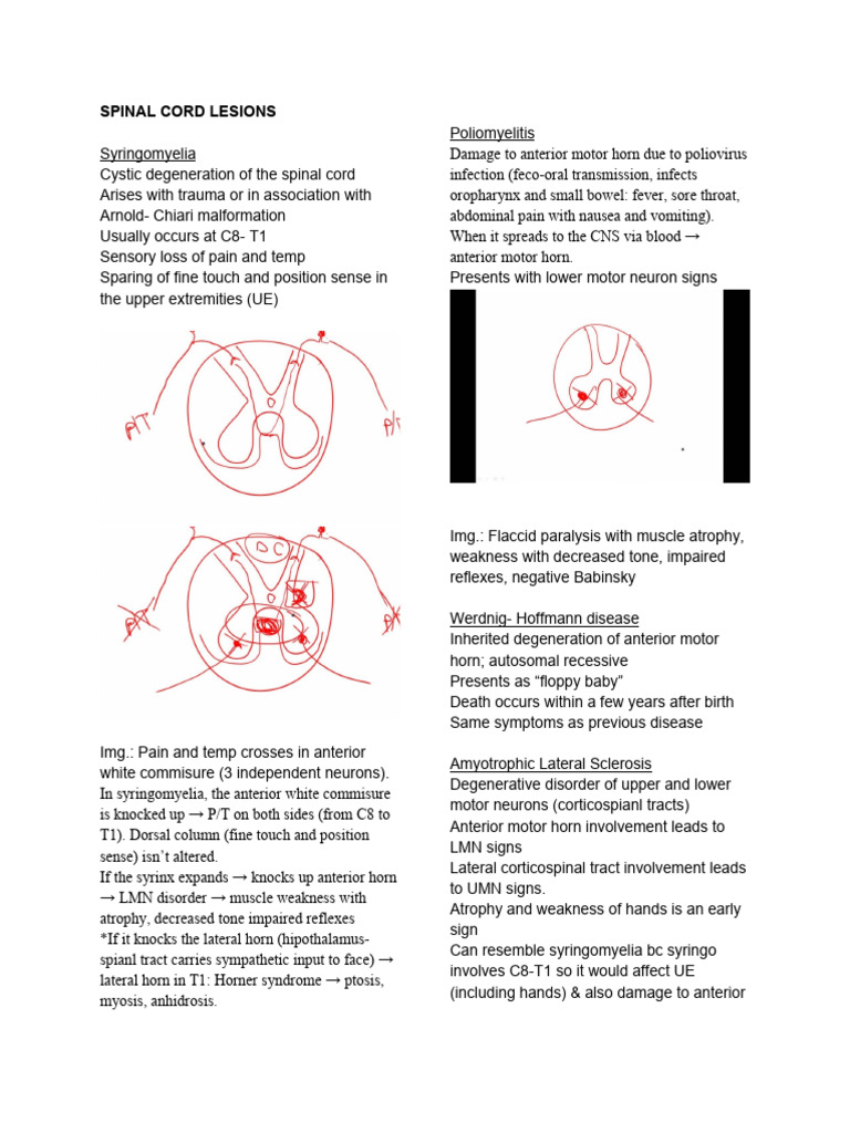 Spinal Cord Lesions | PDF | Spinal Cord | Neurological Disorders