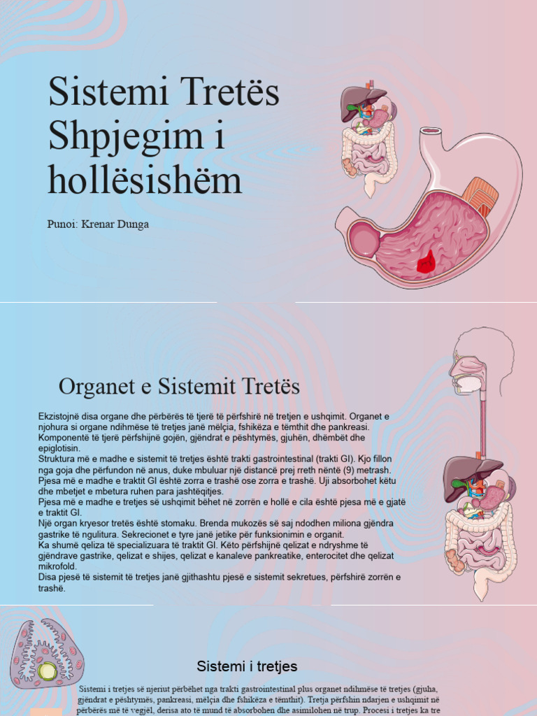 Sistemi Tretes | PDF