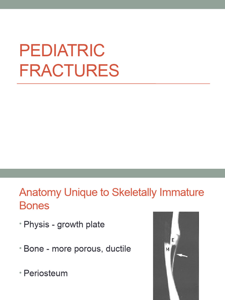 Pediatric Fractures: Diagnosis & Treatment | PDF | Child Abuse | Fracture