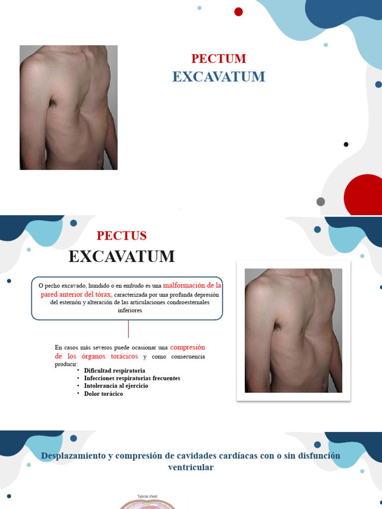 Pectum DESKTOP MQFNGGC | PDF