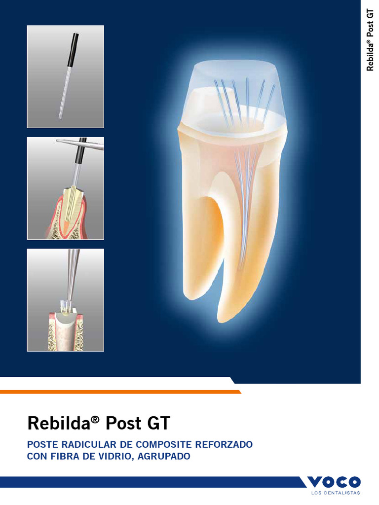 Rebilda-Post-Gt Fol Es | PDF | Compuesto Dental | Materiales