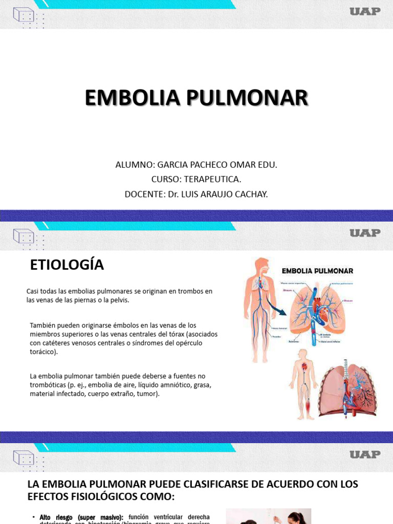 EMBOLIA PULMONAR-garcia pacheco omar edu | PDF | Embolia | Enfermedades ...