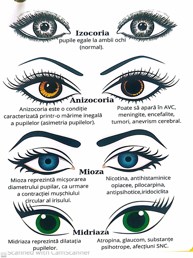 Izocoria Anizocoria Mioza Midraza | PDF