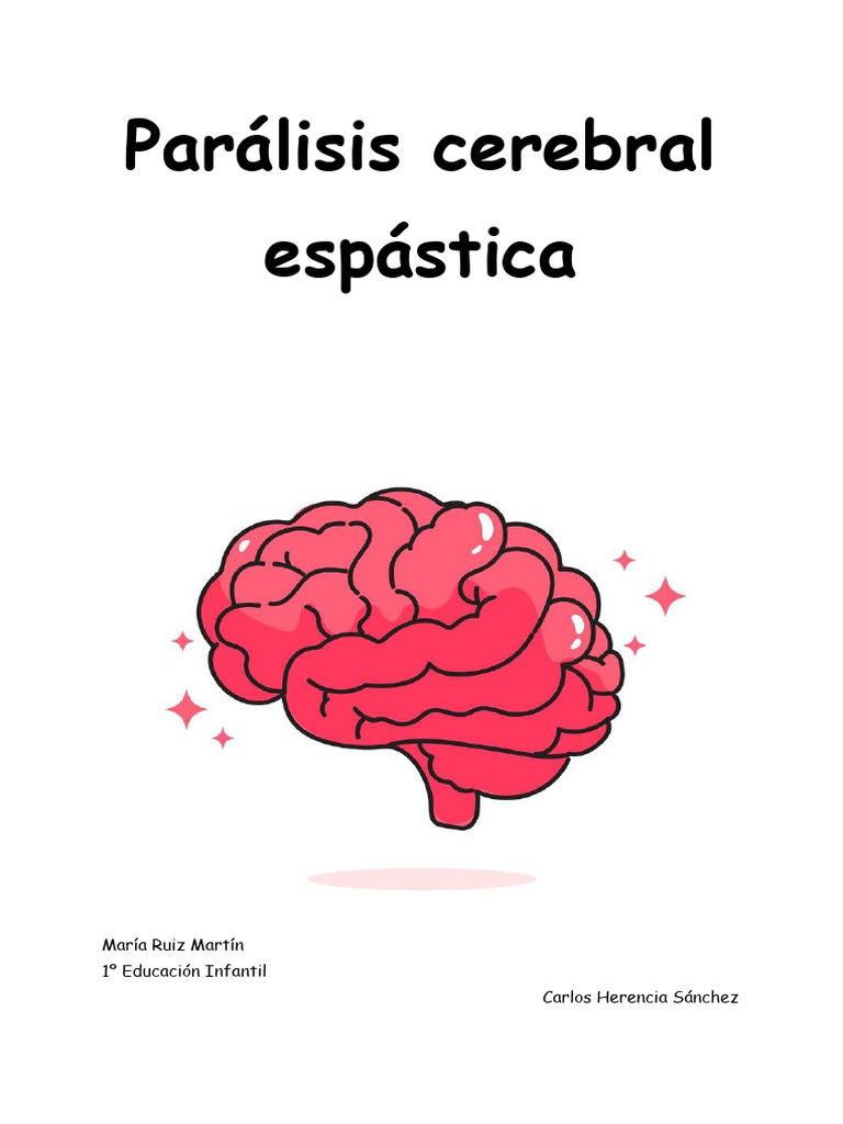 Parálisis Cerebral Espástica | Descargar gratis PDF | Parálisis ...