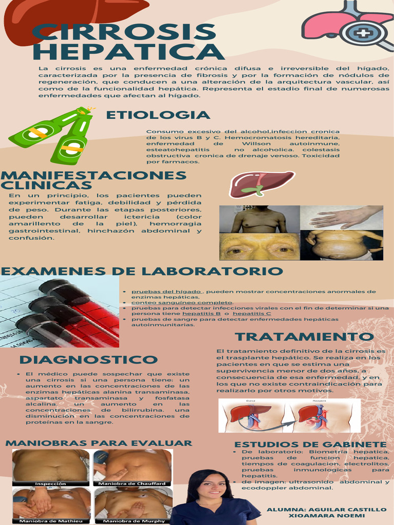 Cirrosis Infografia | Descargar gratis PDF | Cirrosis | Hepatitis