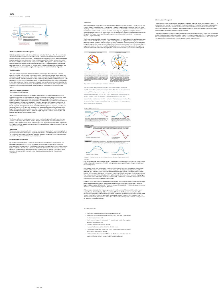 The P-Wave, PR Interval and PR Segment | Download Free PDF ...
